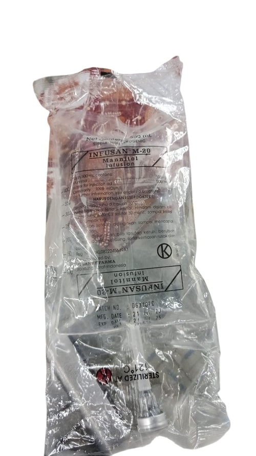 Stronger Neo-Minophagen C Injeksi 20mL – Obat I.V. untuk Terapi Hati ...